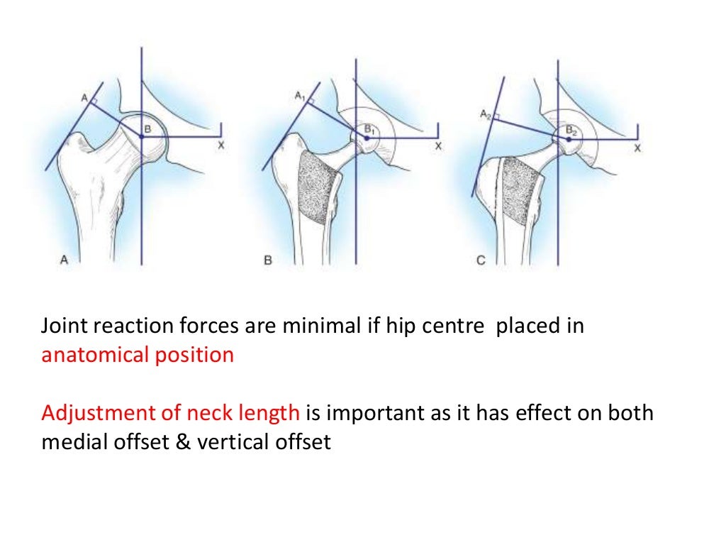 Hip biomechanics