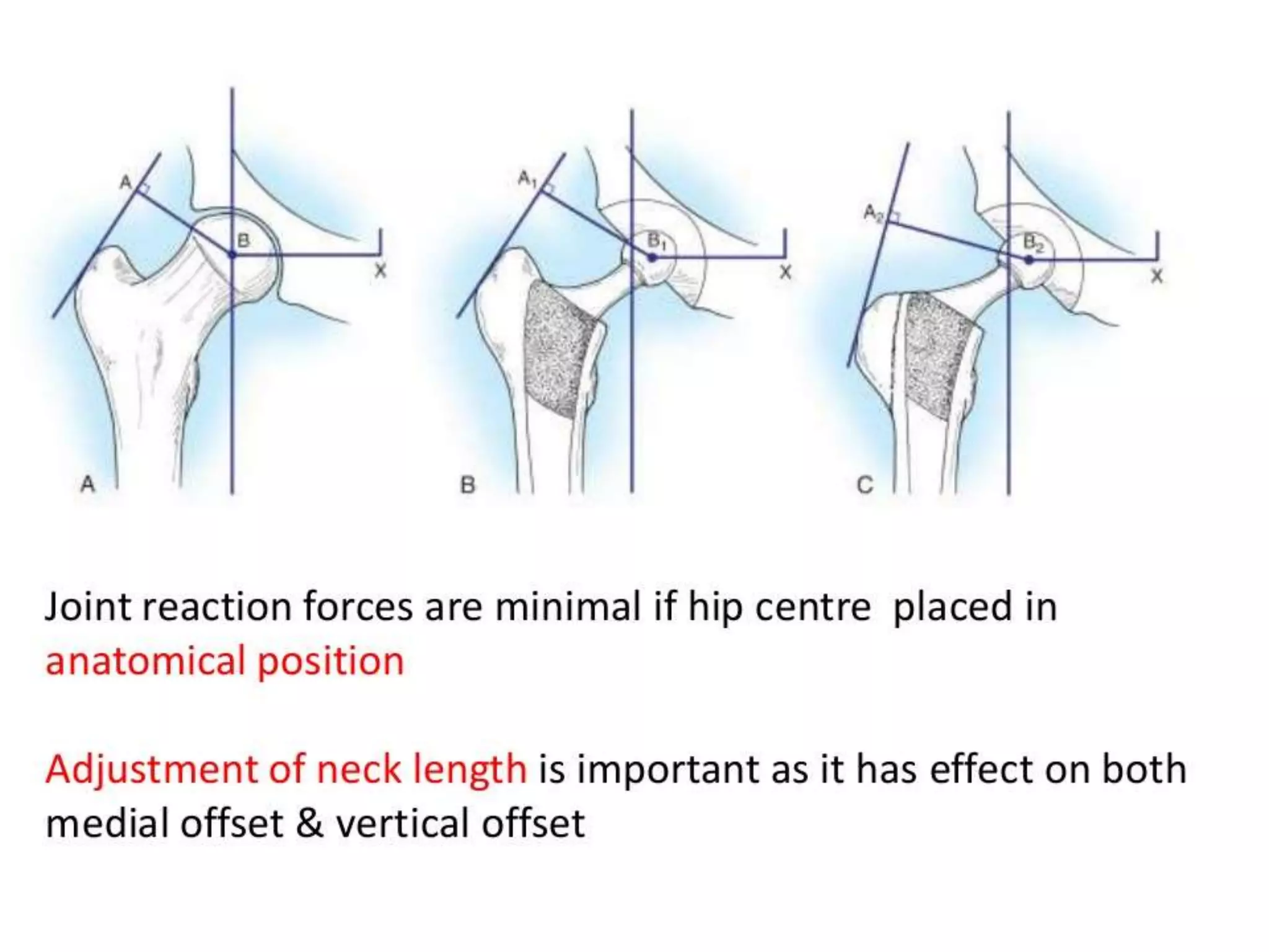 Hip biomechanics | PPT