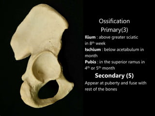 HipBone - ilium 123212334455275426773.pptx