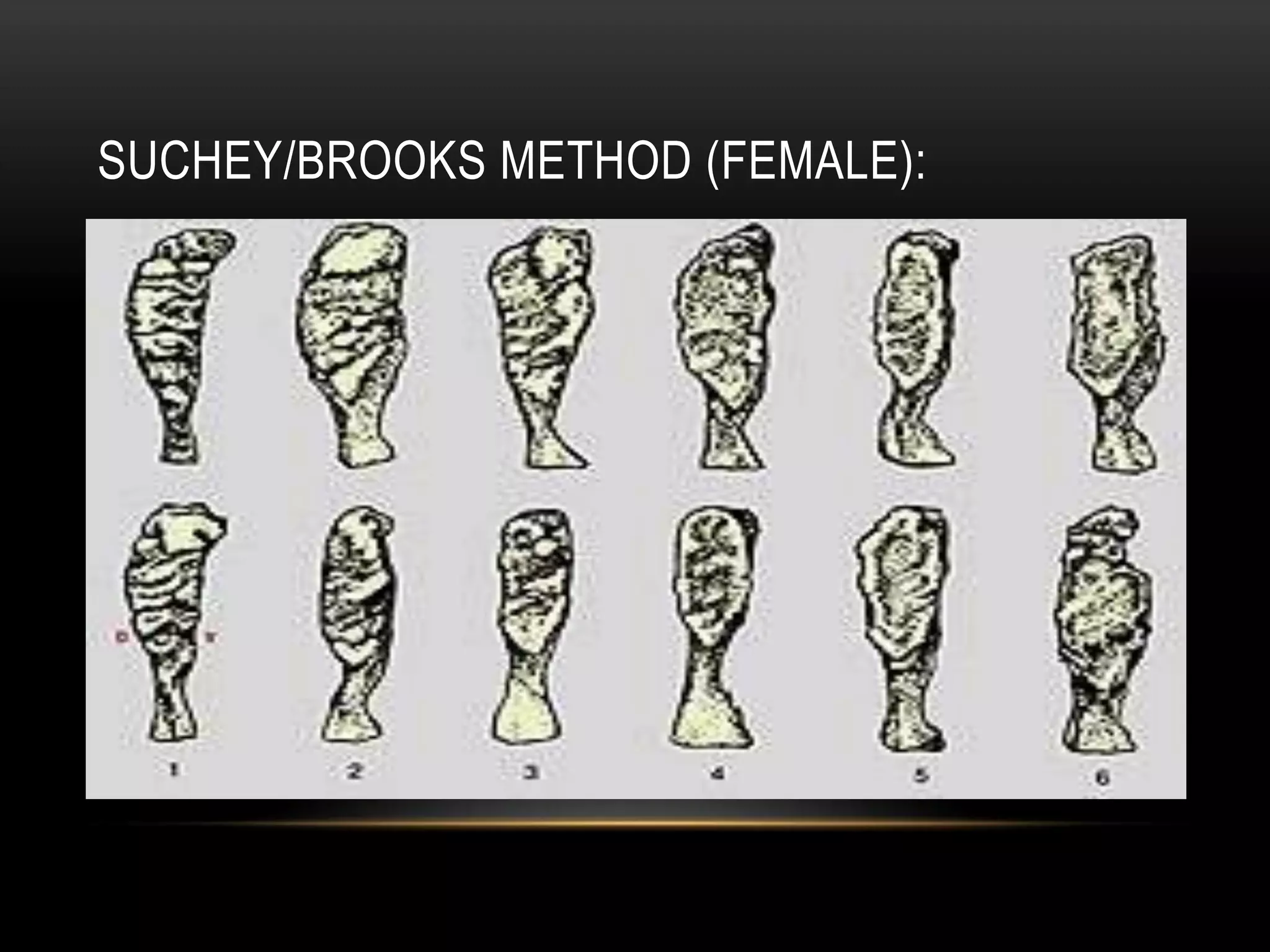 Hip bone and Its Medicolegal Importance | PPTX