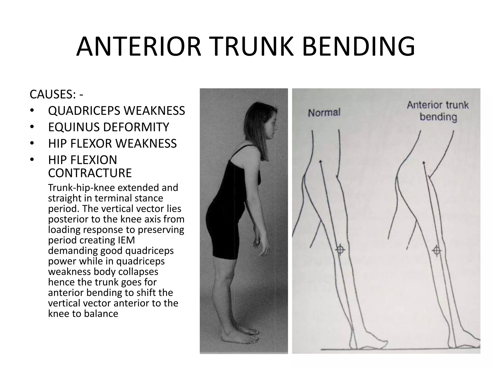 Hip clinical examination By Dr YAGNIK BHUVA | PPT