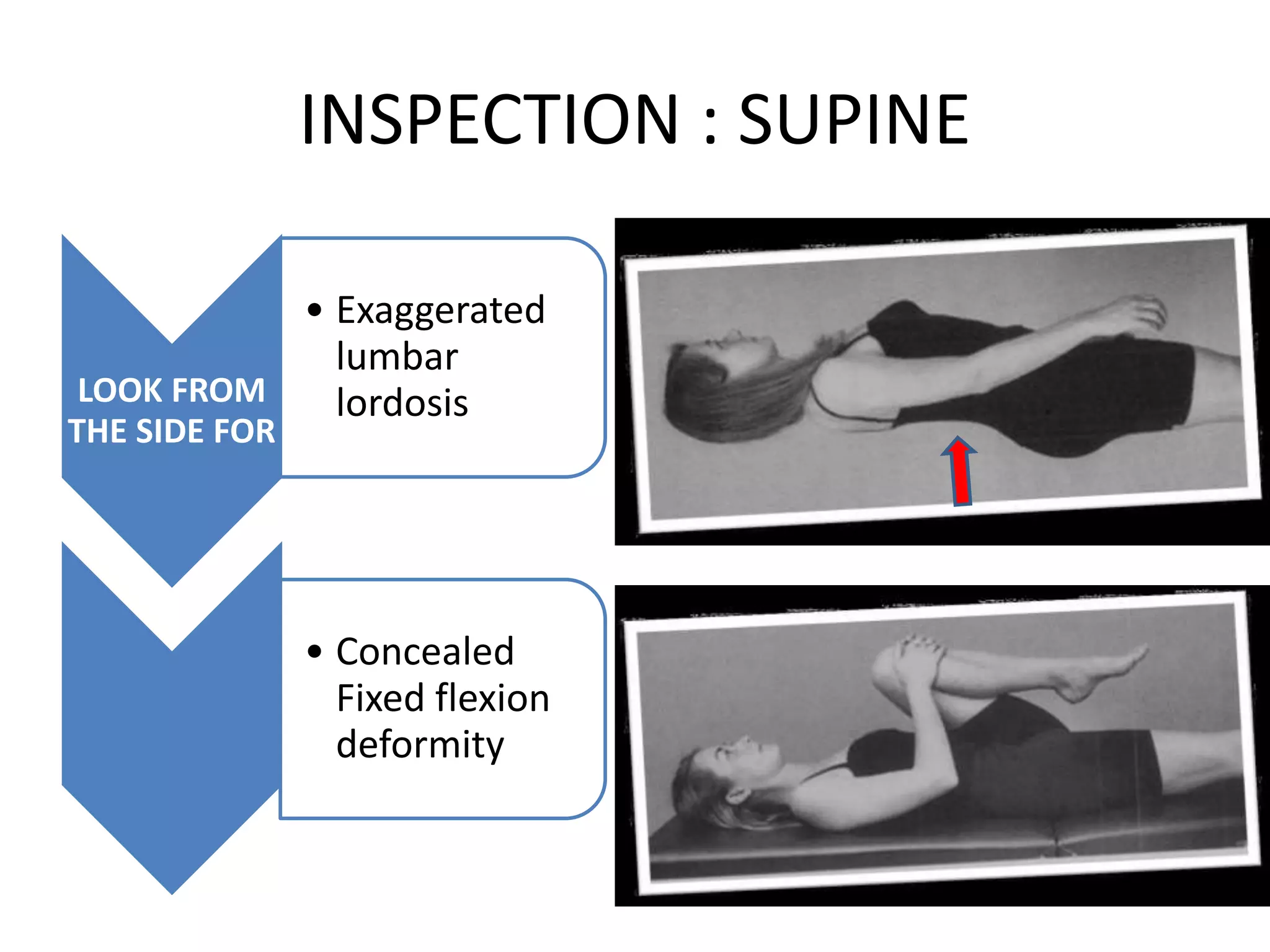 Hip clinical examination By Dr YAGNIK BHUVA | PPT