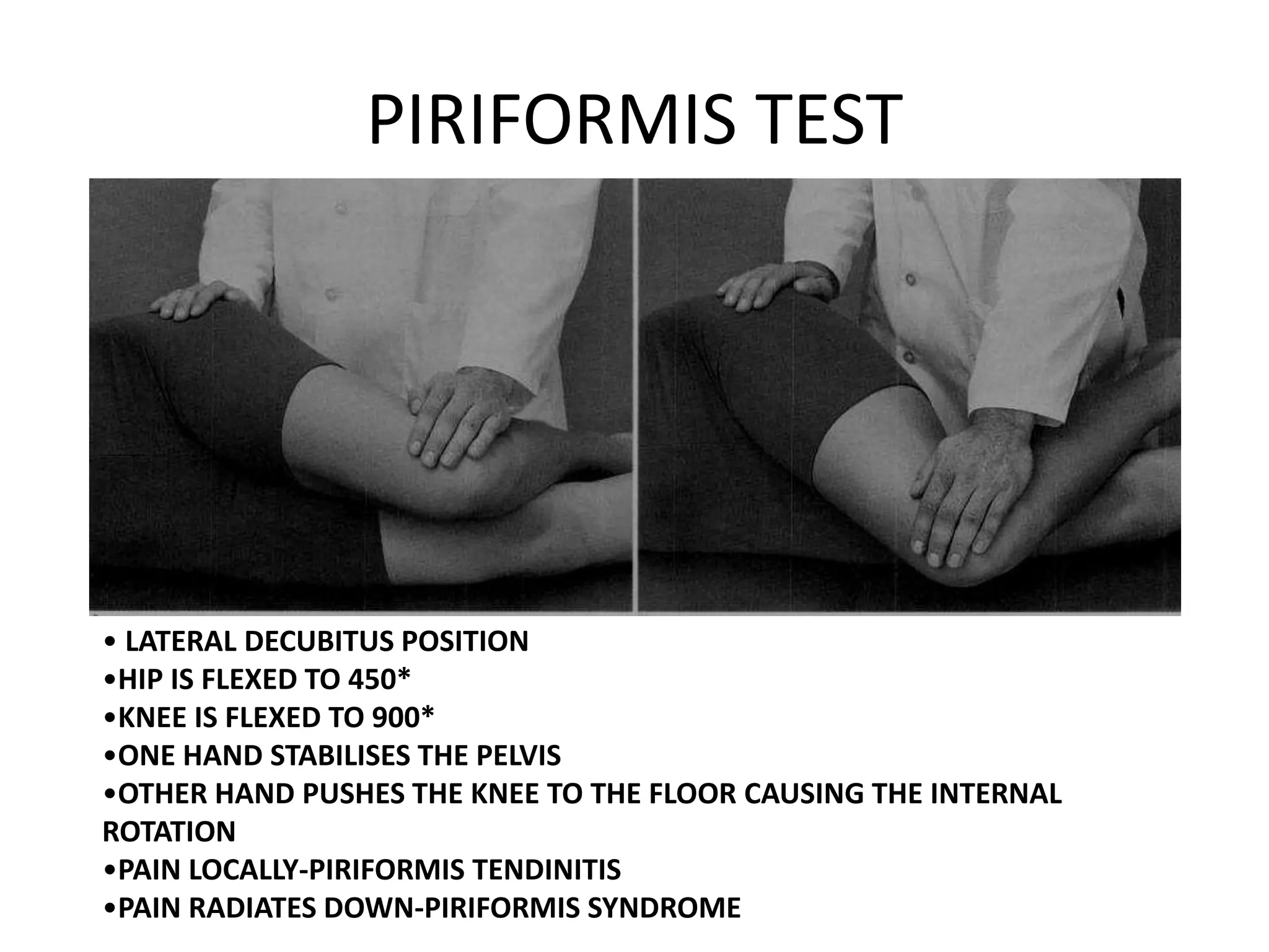 Hip clinical examination By Dr YAGNIK BHUVA | PPT