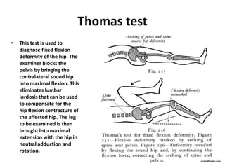 Hip clinical examination By Dr YAGNIK BHUVA | PPT