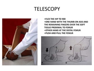 Hip clinical examination By Dr YAGNIK BHUVA | PPT