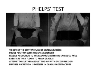 Hip clinical examination By Dr YAGNIK BHUVA | PPT