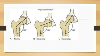 Hip complex Biomechanics | PPTX