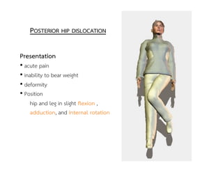 posterior hip dislocation | PDF