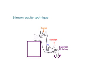 posterior hip dislocation | PDF