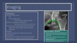 Hip dislocate mew | PPT