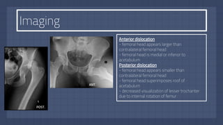 Hip dislocate mew | PPT