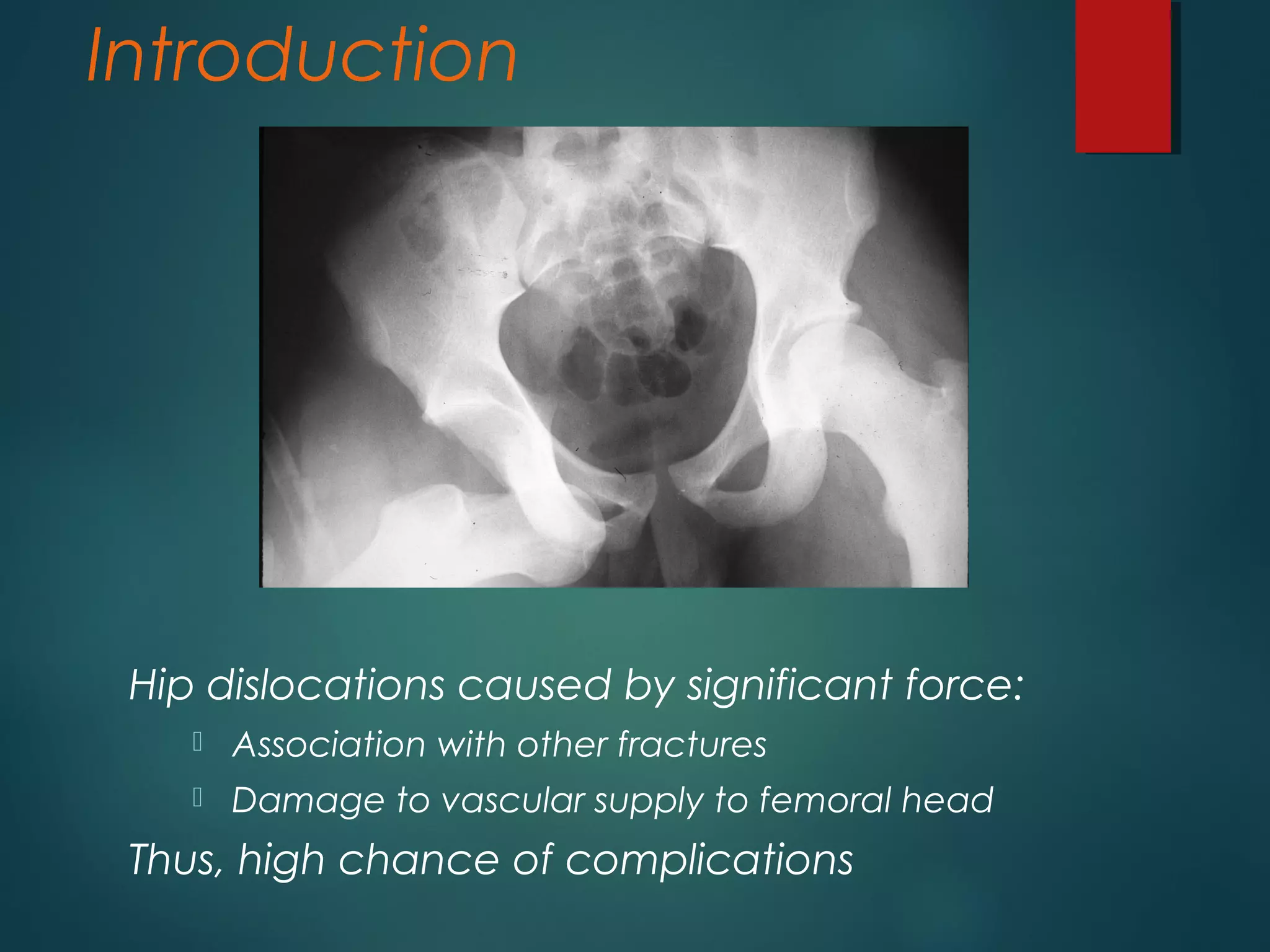 Hip dislocation | PPT