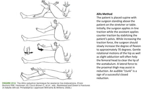 Hip dislocation | PPTX
