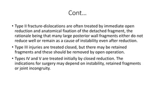 Hip dislocation | PPTX