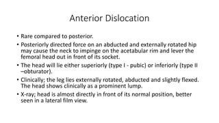 Hip dislocation | PPTX