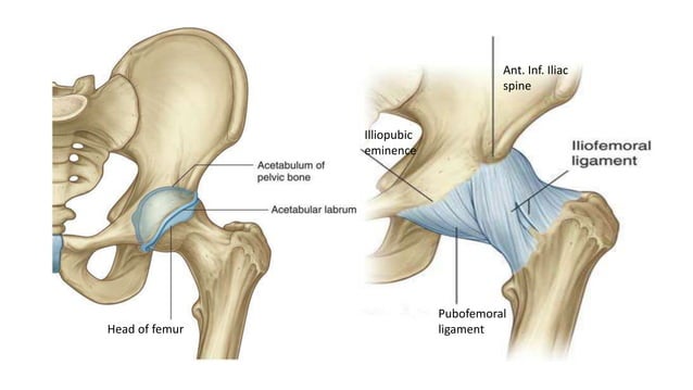 Hip dislocation | PPTX