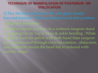 Hip dislocation | PPTX