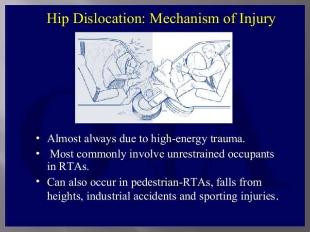 Hip Dislocation Ppt 3933