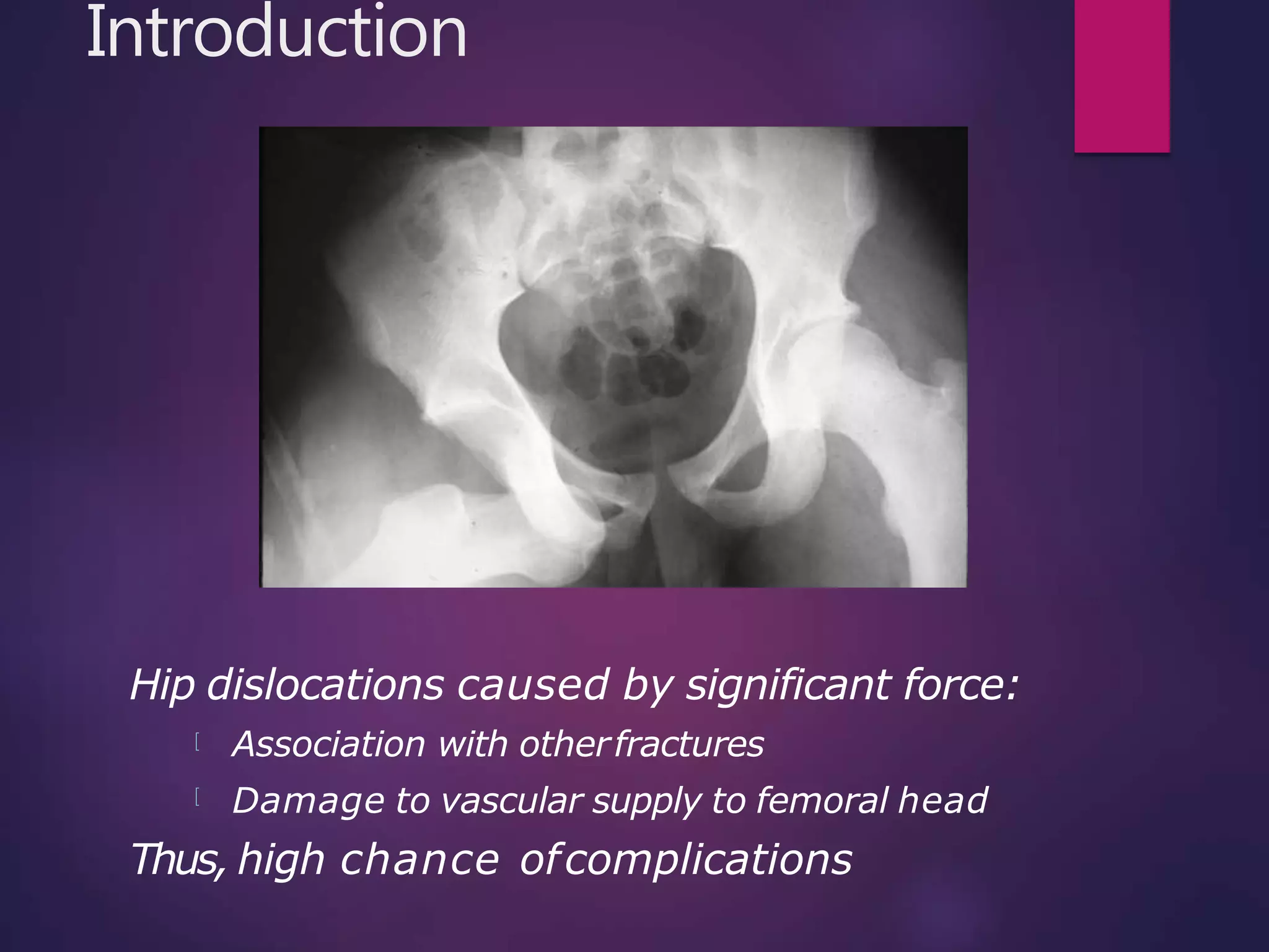 Hip dislocation | PPTX