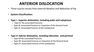 Hip dislocation | PPTX