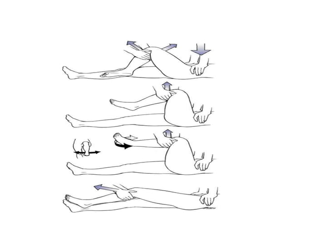 Hip Dislocationpptx Ppt