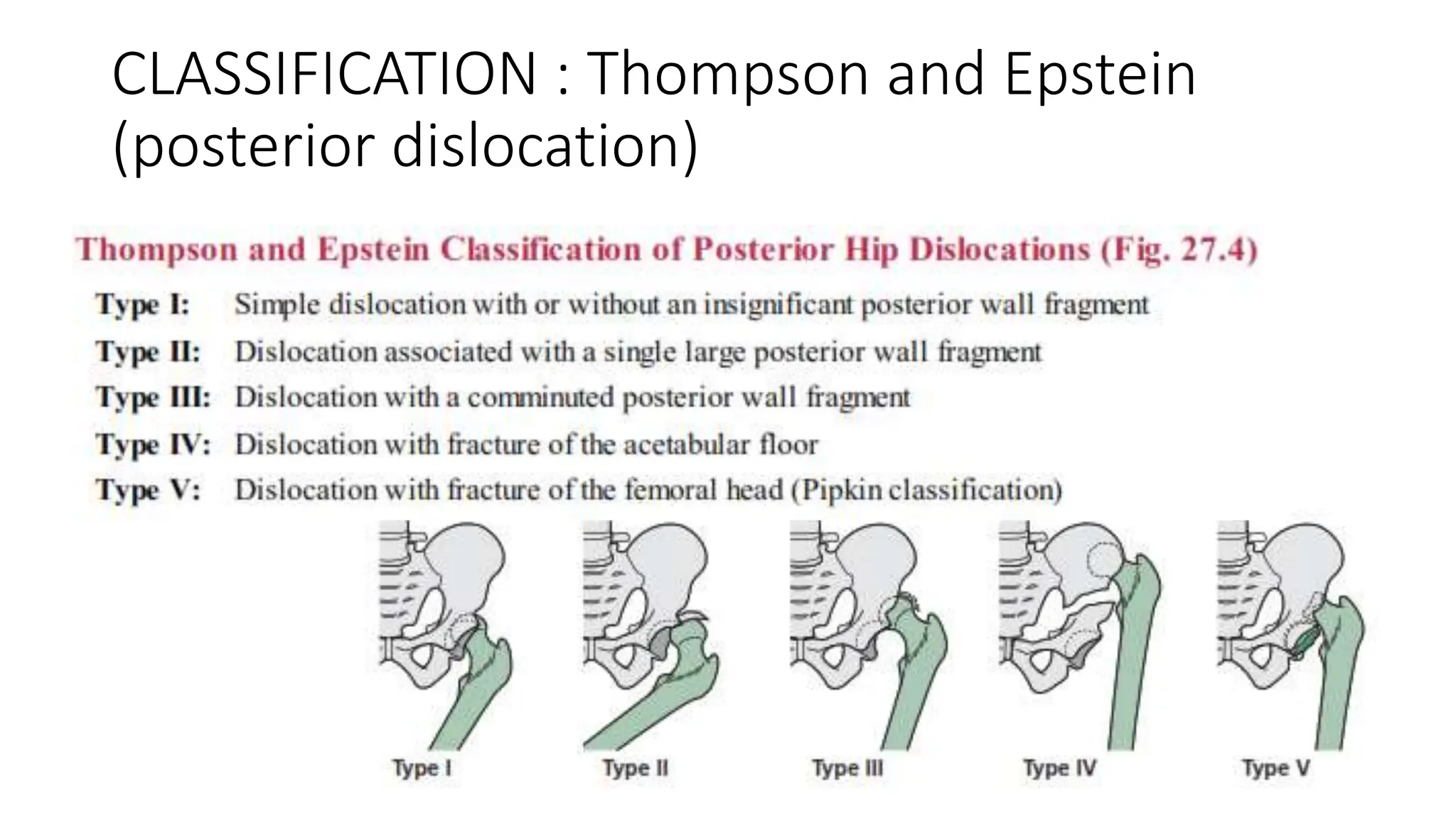 hip dislocation, anatomy, history, diagnosis, treatment and management.pptx