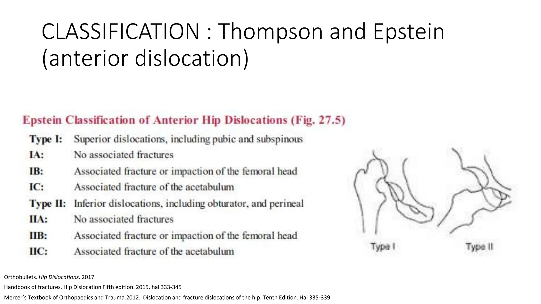 hip dislocation, anatomy, history, diagnosis, treatment and management ...
