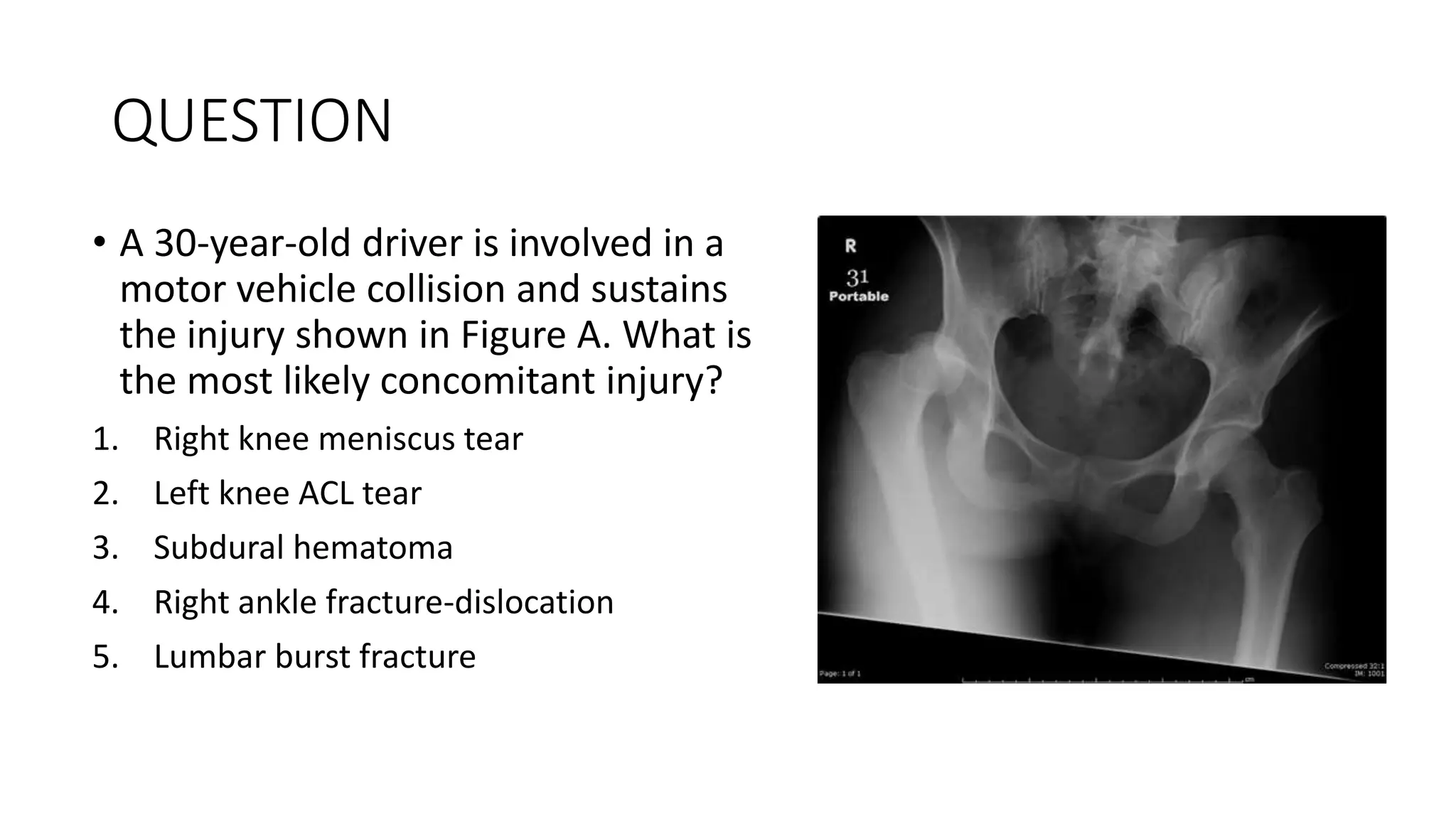 hip dislocation, anatomy, history, diagnosis, treatment and management ...