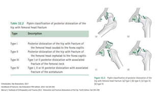 hip dislocation, anatomy, history, diagnosis, treatment and management.pptx