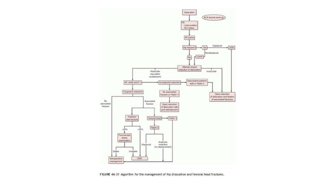 hip dislocation, anatomy, history, diagnosis, treatment and management.pptx