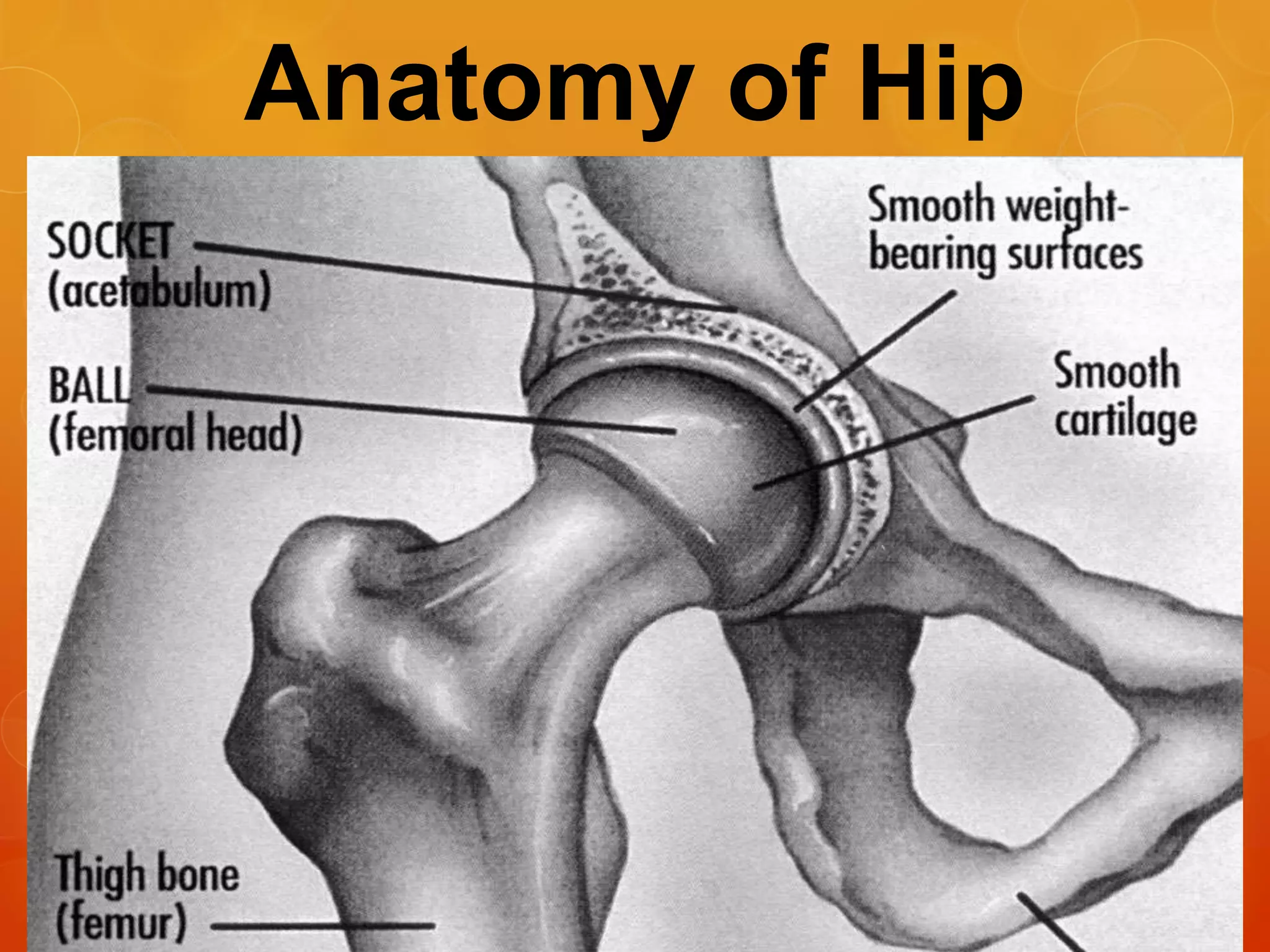 Hip dislocation ppt | PPT | Free Download