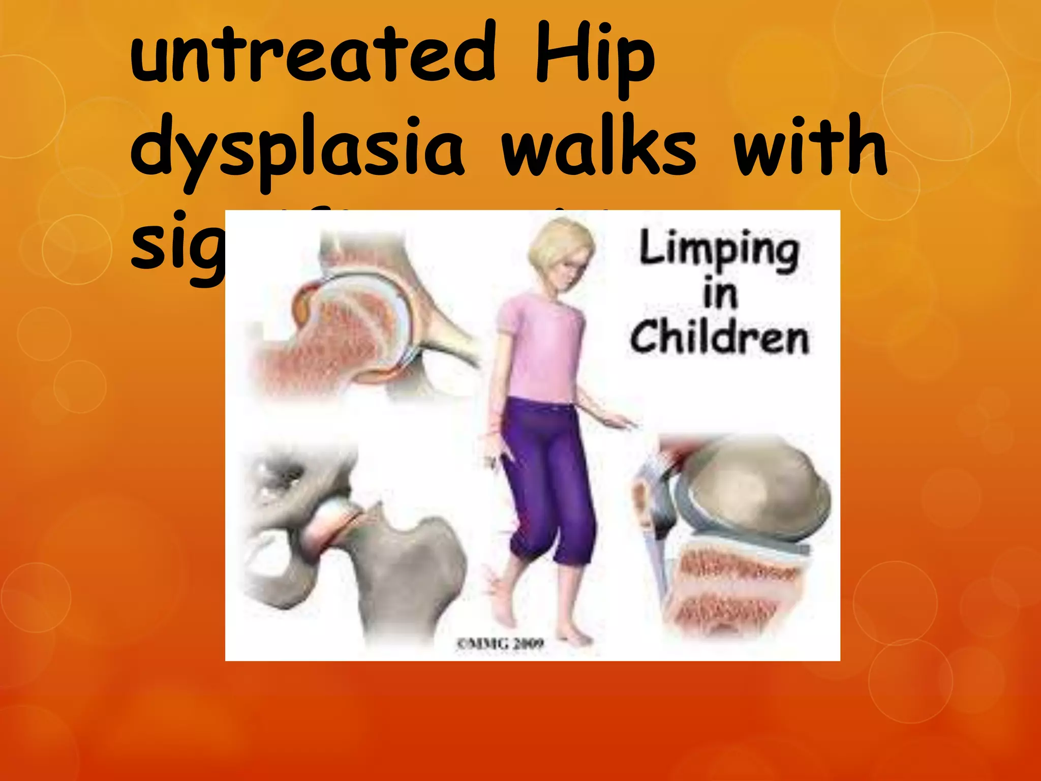 Hip dislocation ppt | PPT