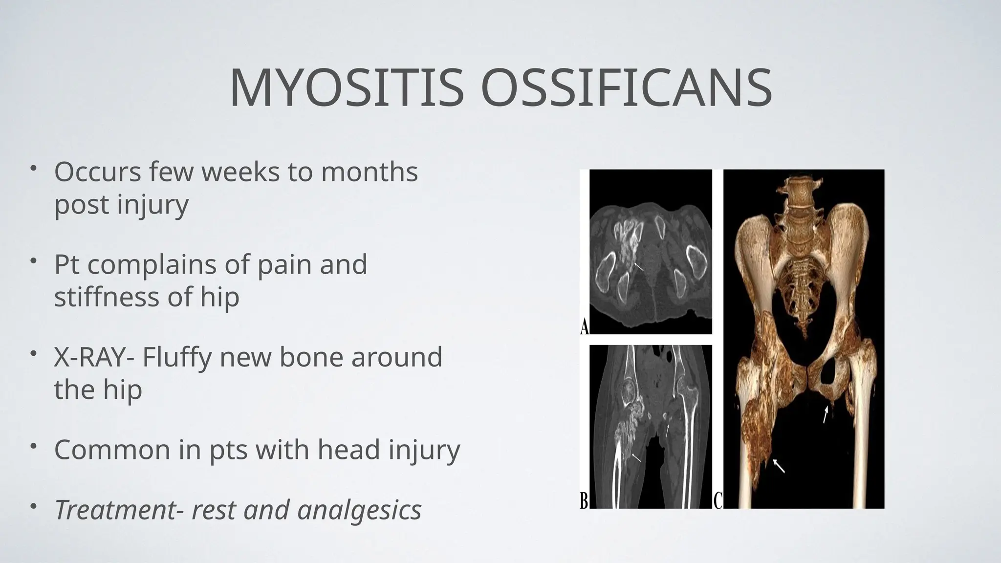 Hip dislocation presentation orthopedic.pptx