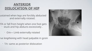 Hip dislocation presentation orthopedic.pptx