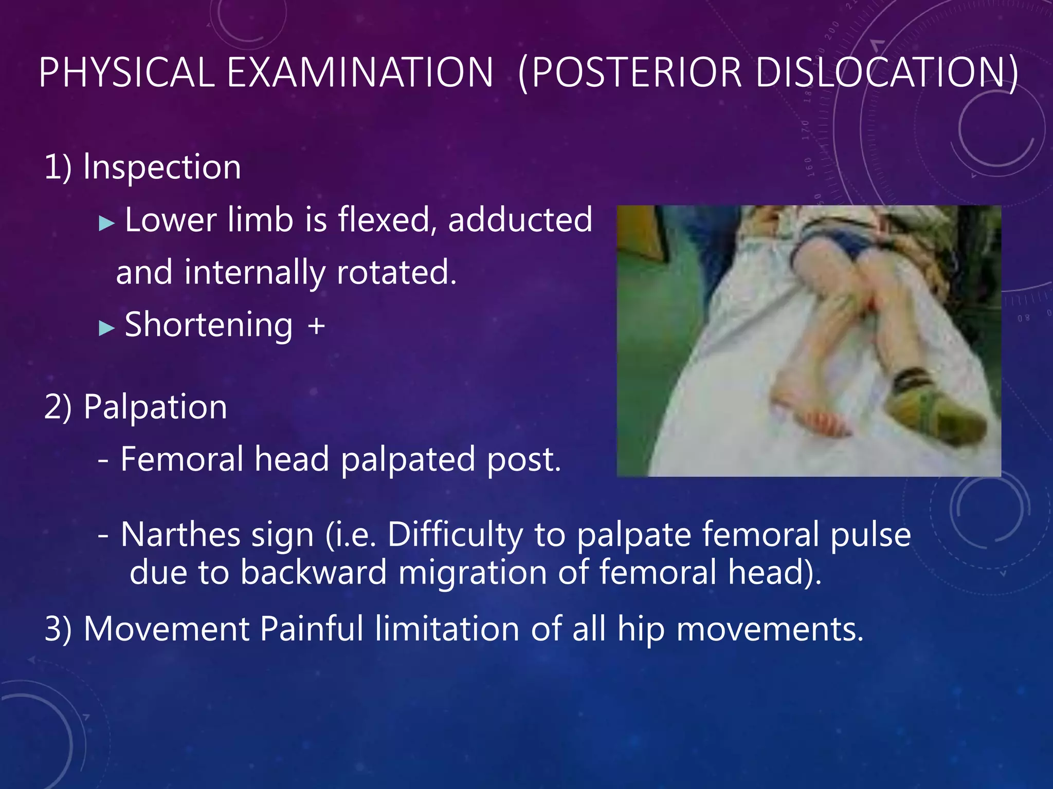 Hip Dislocation PPT FINAL.pptx