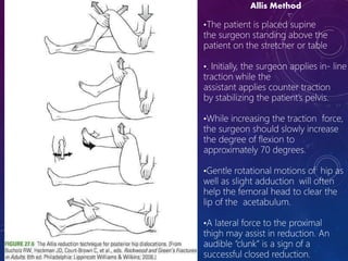 Hip Dislocation PPT FINAL.pptx