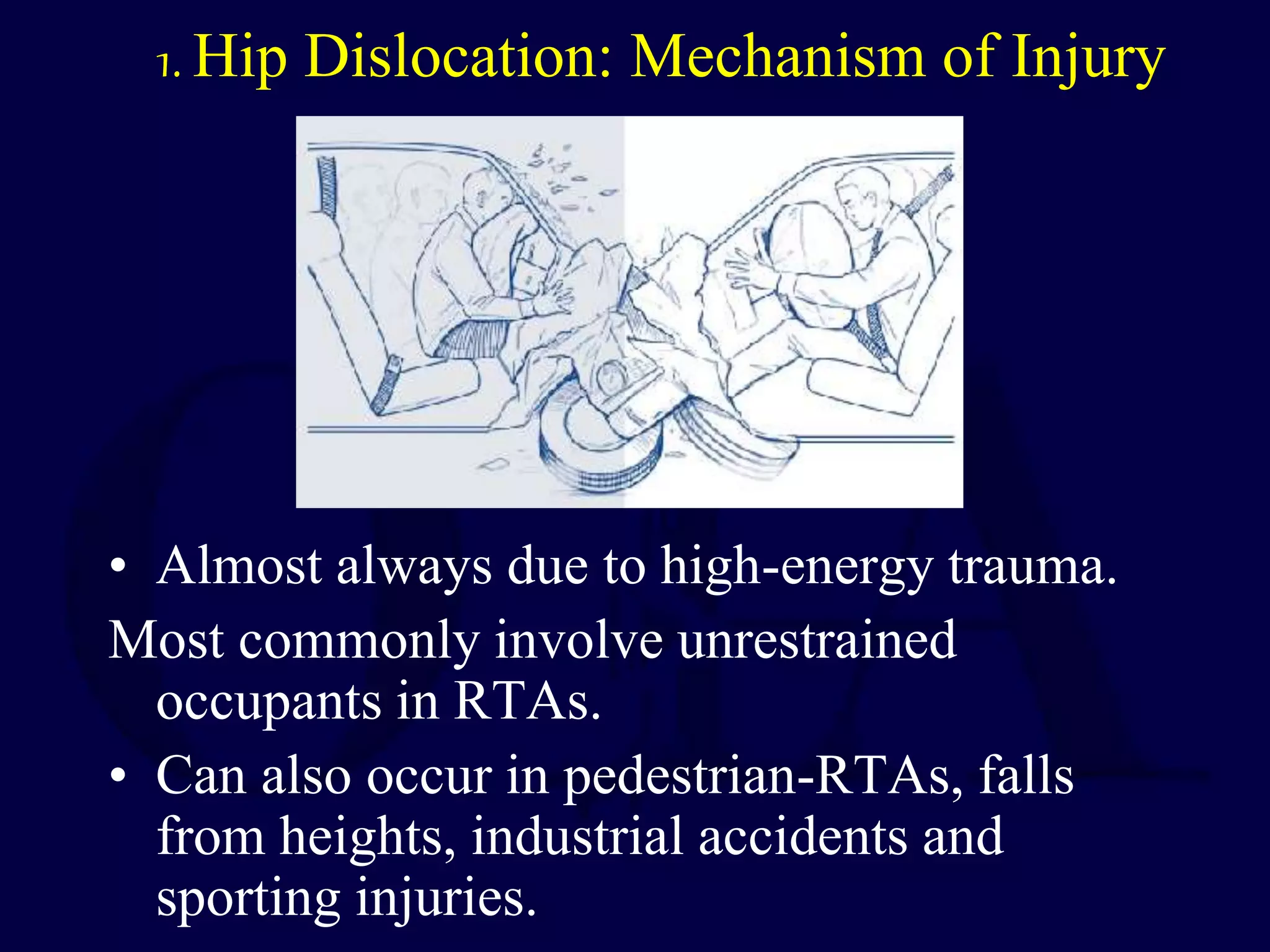 Hip dislocations and femoral head fractures | PPT