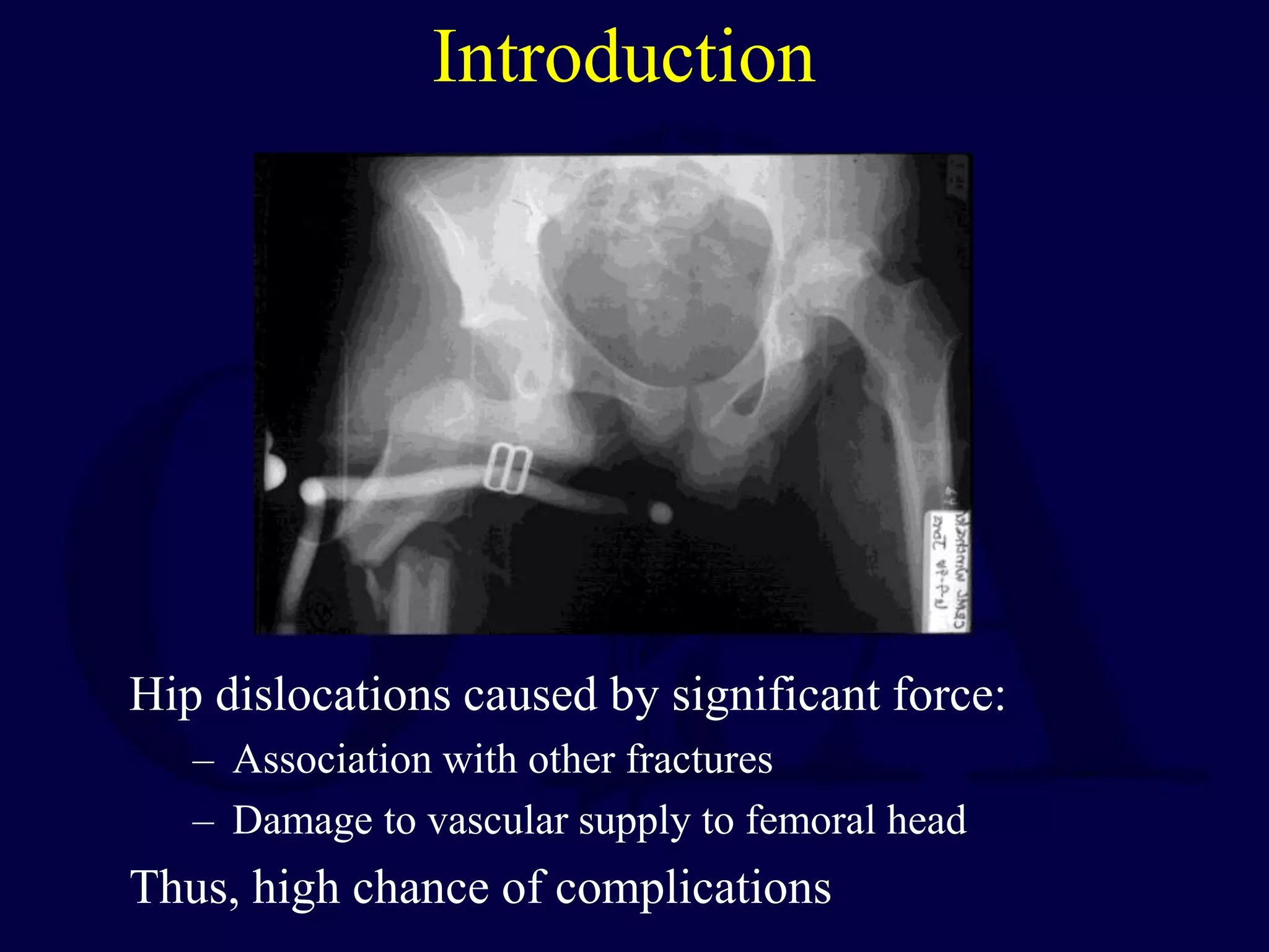 Hip dislocations and femoral head fractures | PPT