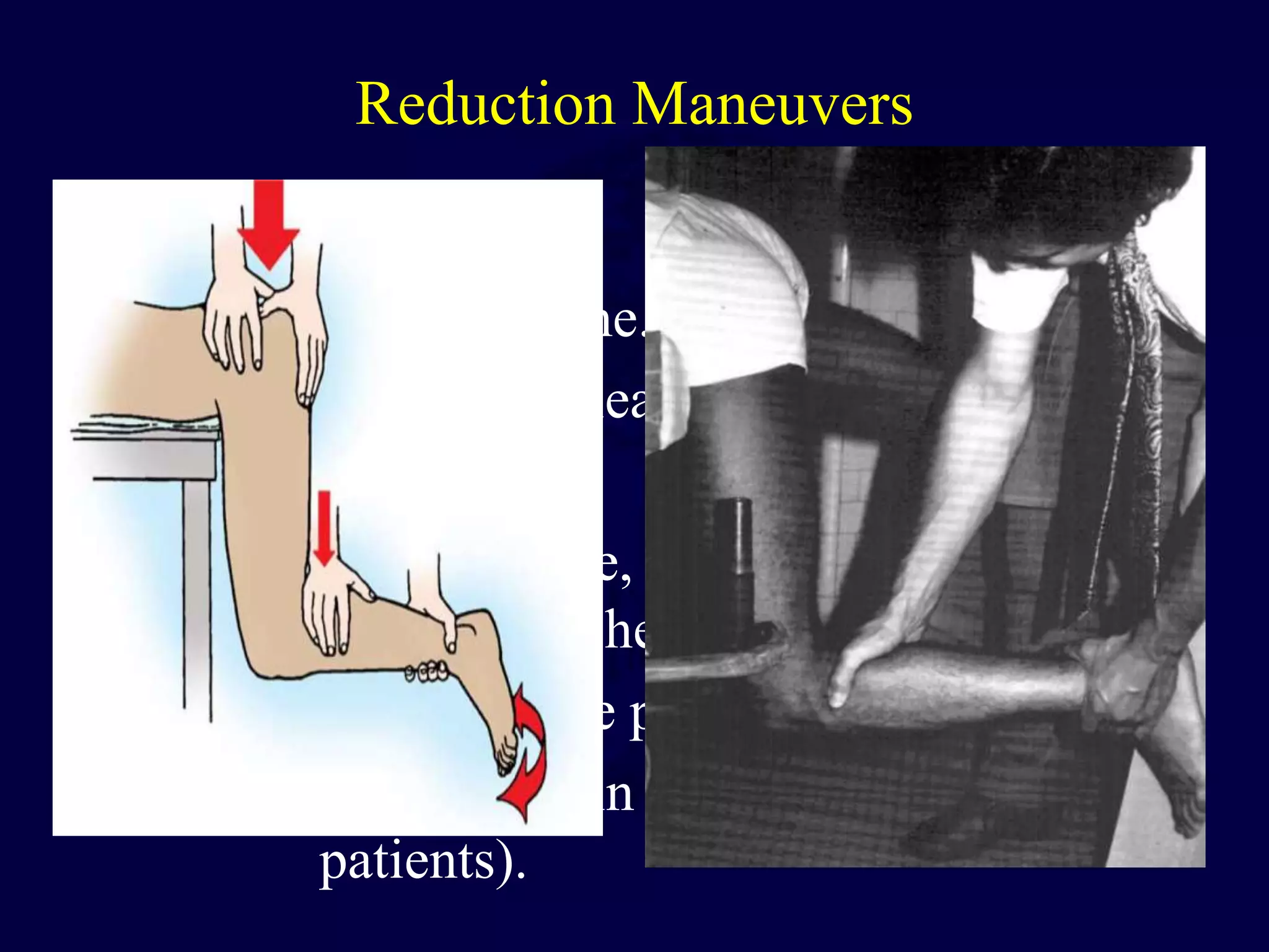 Hip dislocations and femoral head fractures | PPT