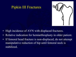 Hip dislocations and femoral head fractures | PPT