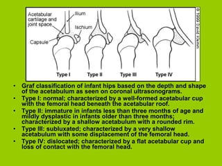 Hip dysplasia imaging . | PPT