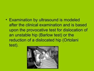 Hip dysplasia imaging . | PPT