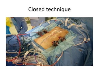 HIPEC with CRS in ADVANCED CARCINOMA OVARY | PPTX