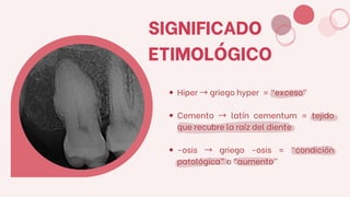 HIPERCEMENTOSIS (presentación de patología Bucal ).pdf