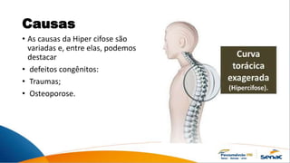 hipercifose.pptx