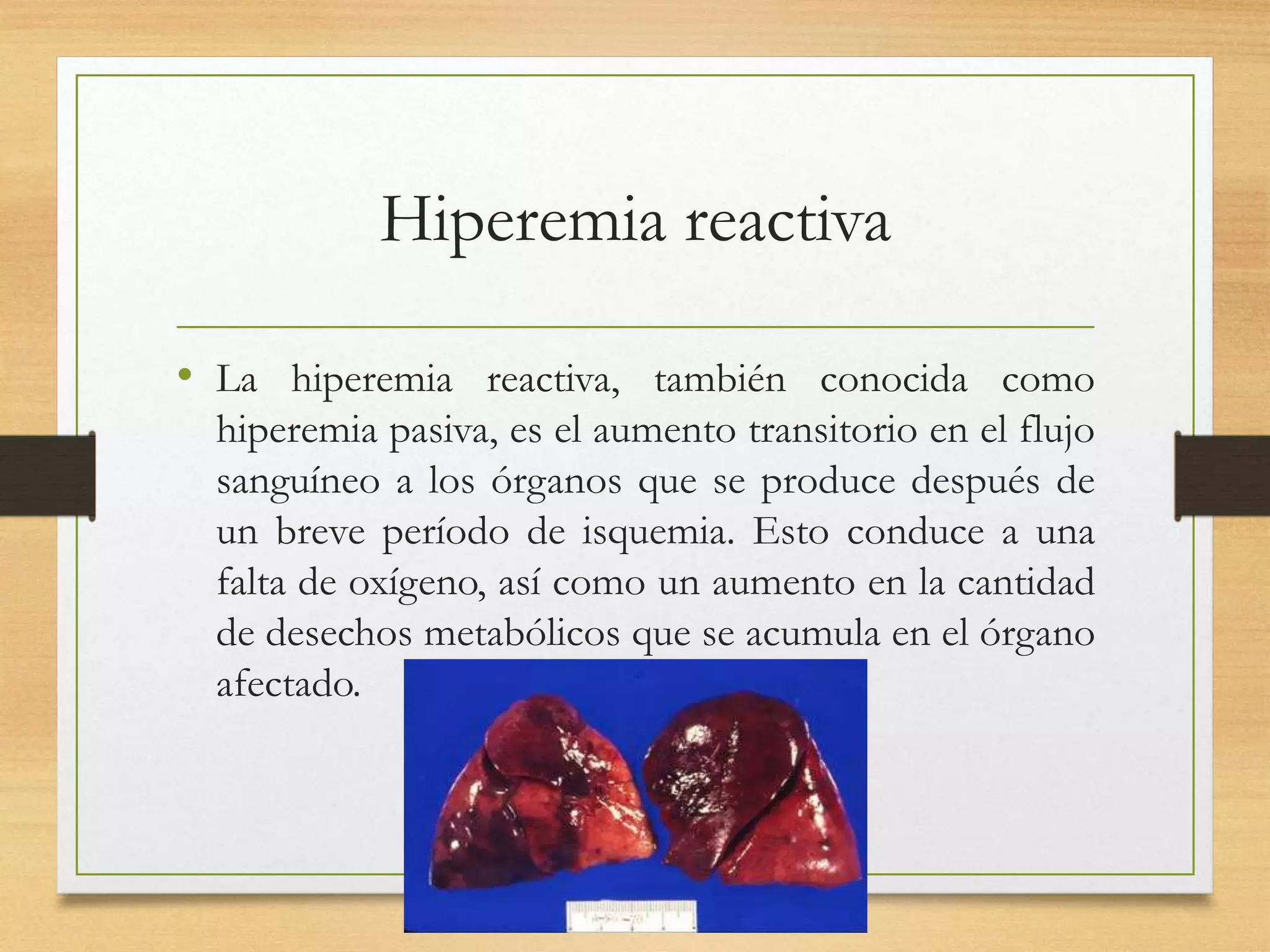 Hiperemia | PPTX | Blood Disorders | Diseases and Conditions