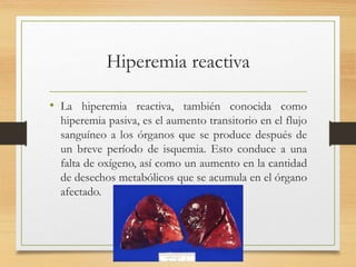 Hiperemia | PPTX