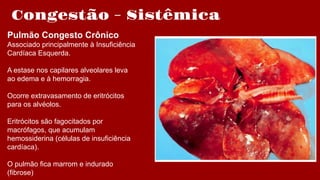 Alteração circulatória: Hiperemia ativa e passiva | PDF