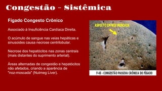 Alteração circulatória: Hiperemia ativa e passiva | PDF