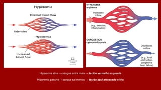 Alteração circulatória: Hiperemia ativa e passiva | PDF